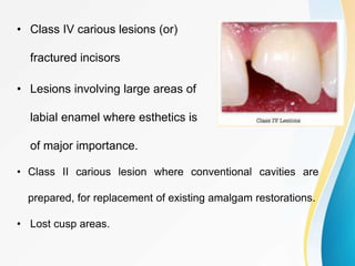 Glass ionomer cement with recent advancements | PPTX