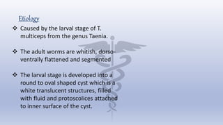 Gid disease in goat and surgical correction.pptx