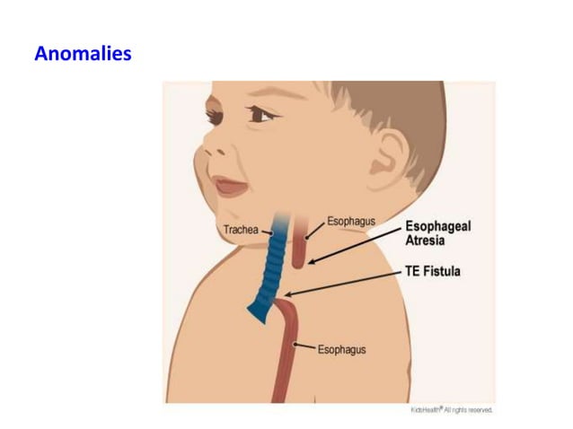 GI development embryology & Concept of Peritoneum | PPTX | Digestive ...
