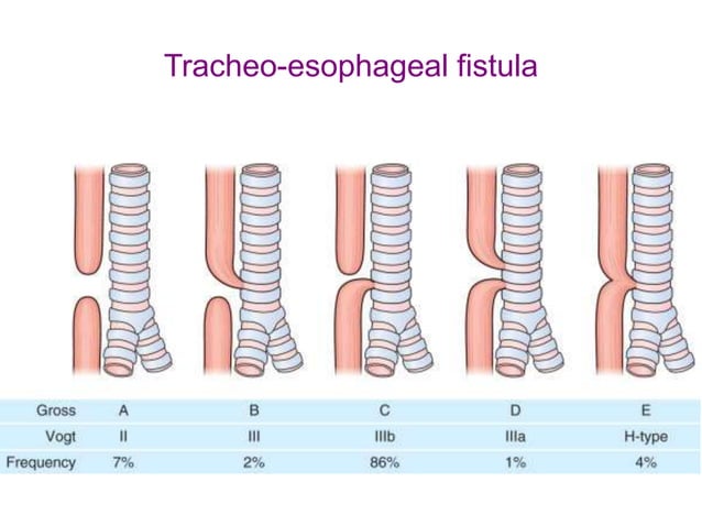 GI development embryology & Concept of Peritoneum | PPTX | Digestive ...