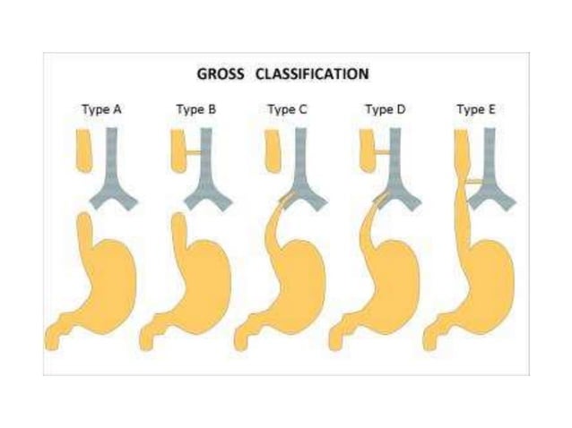 GI development embryology & Concept of Peritoneum | PPTX | Digestive ...
