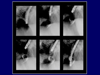 Gi diagnostic & therapeutic endoscopy | PPT