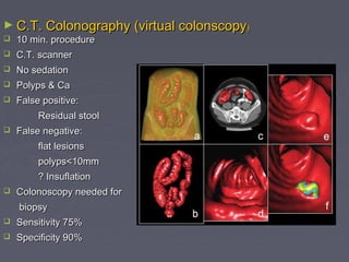 Gi diagnostic & therapeutic endoscopy | PPT