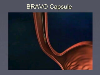Gi diagnostic & therapeutic endoscopy | PPT
