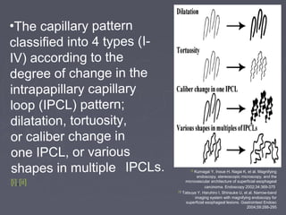 Gi diagnostic & therapeutic endoscopy | PPT