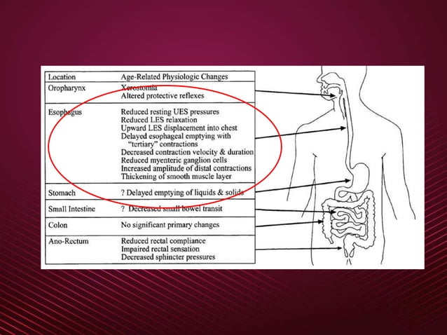 GI Disease in Elderly | PPTX