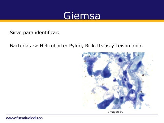 Tincion De Giemsa Fundamento - slingo