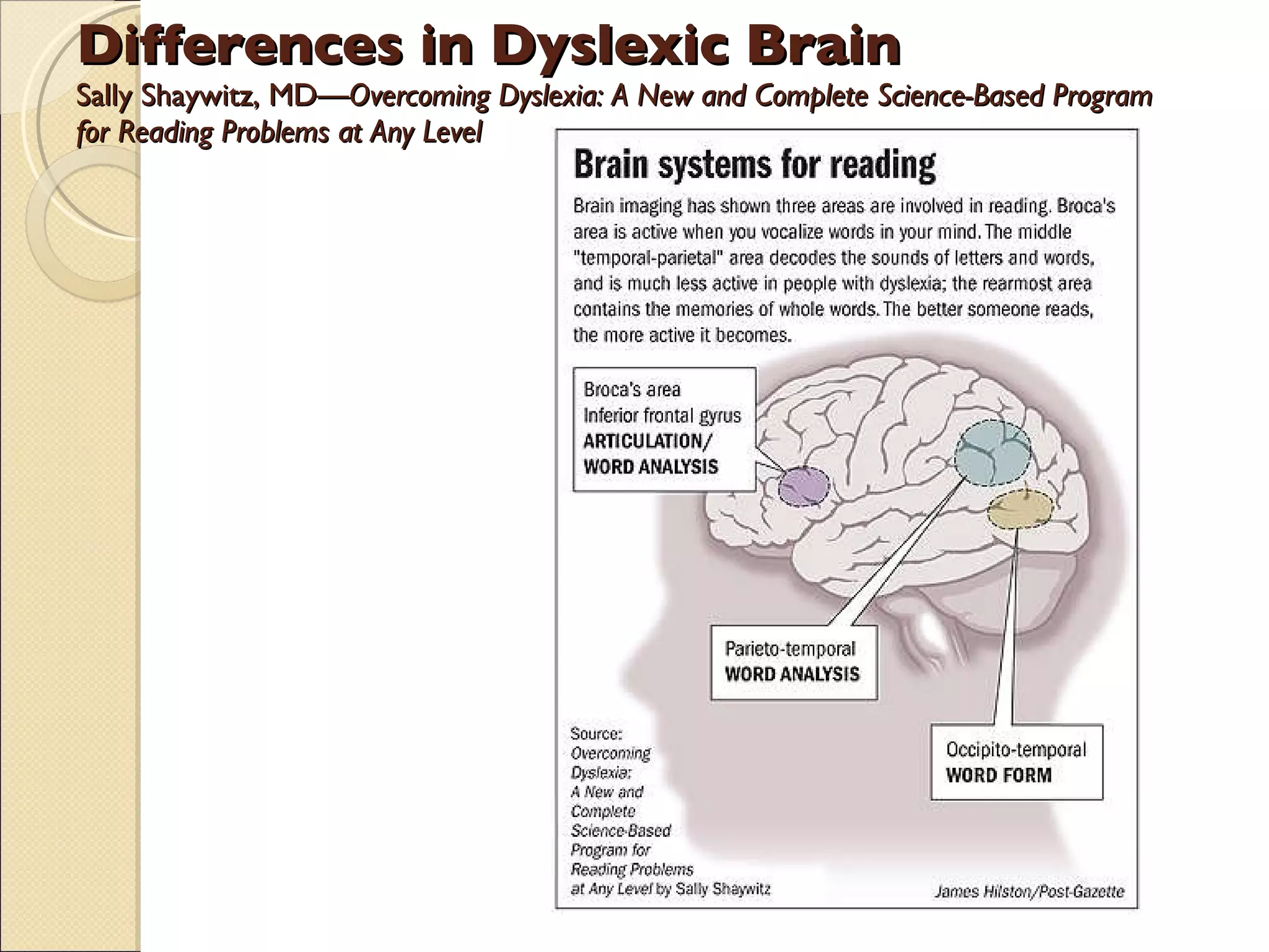 Gifted Students With Dyslexia | PPT