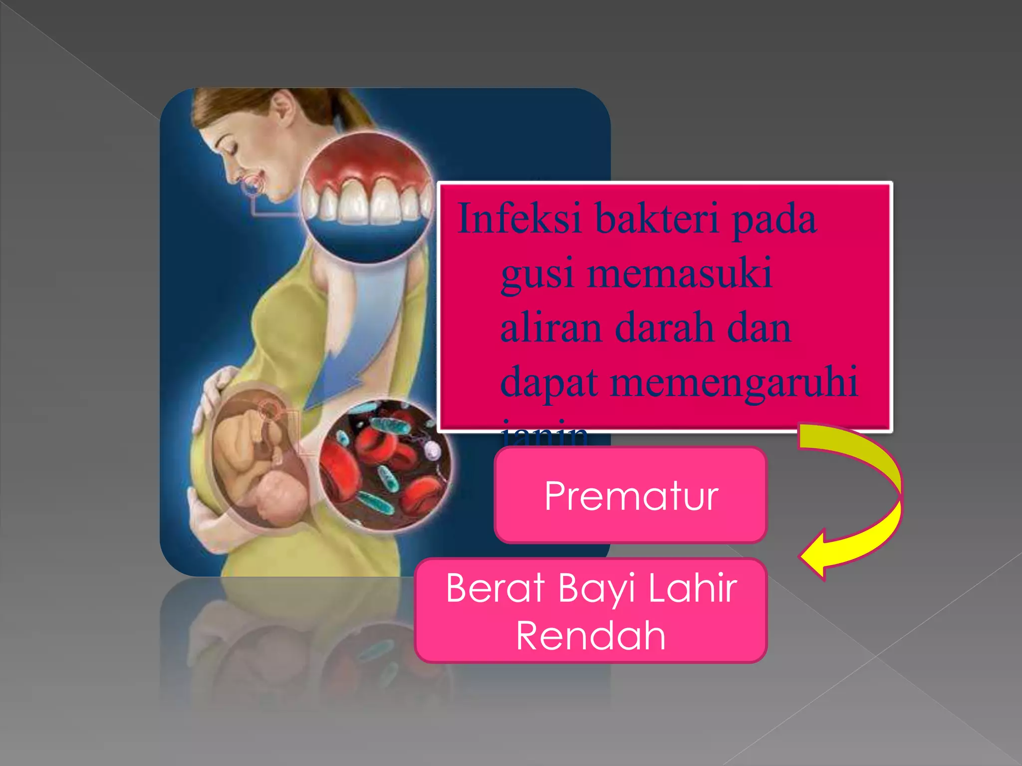 Gigi Sehat Ibu Hamil | PPTX