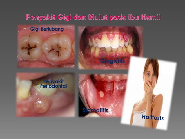 Gigi Sehat Ibu Hamil | PPTX