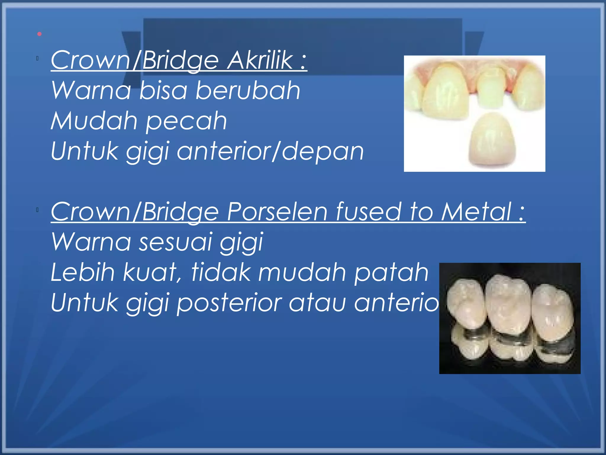 Gigi tiruan (power point) | PPT