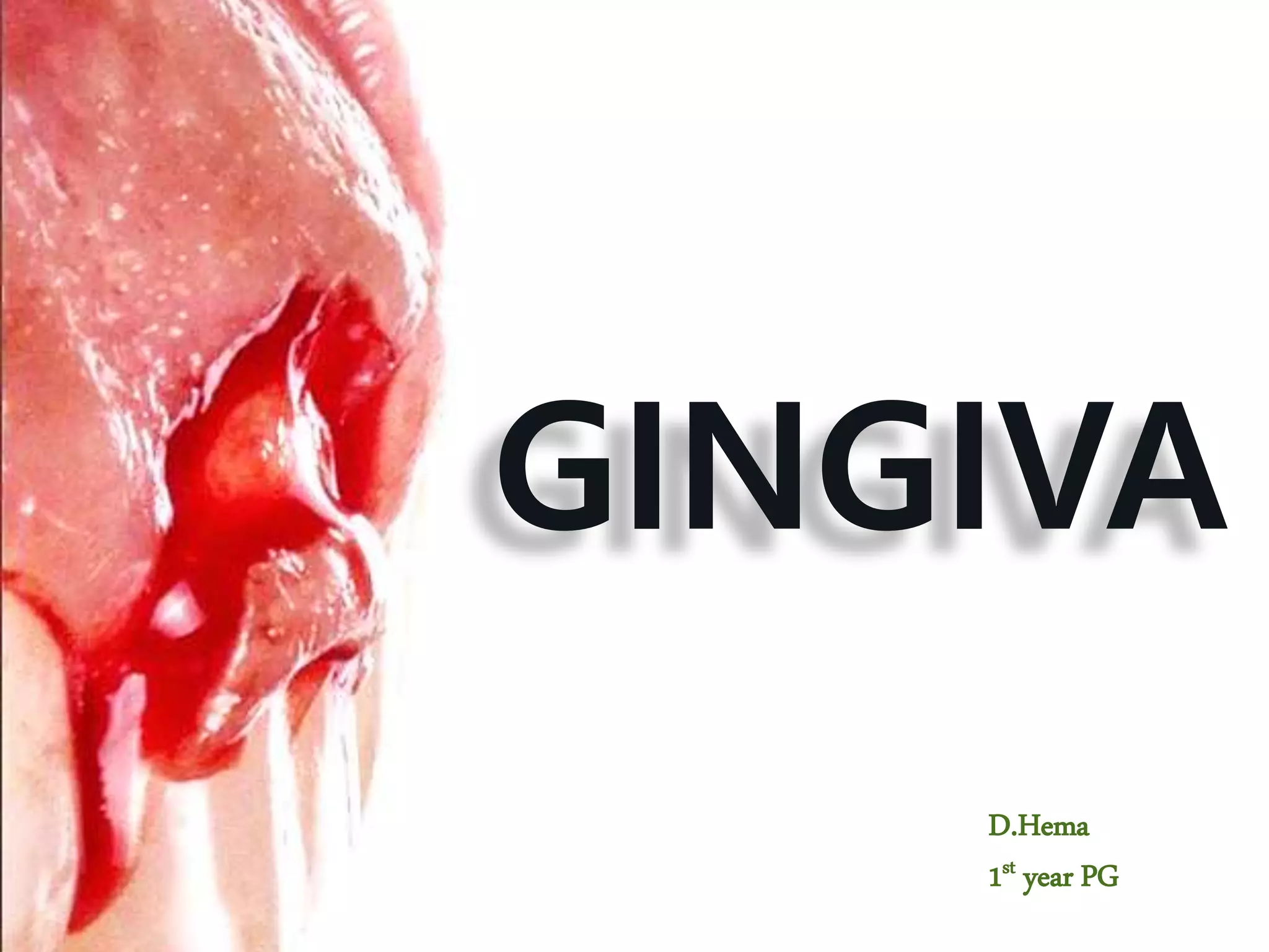 Gingiva | PPTX