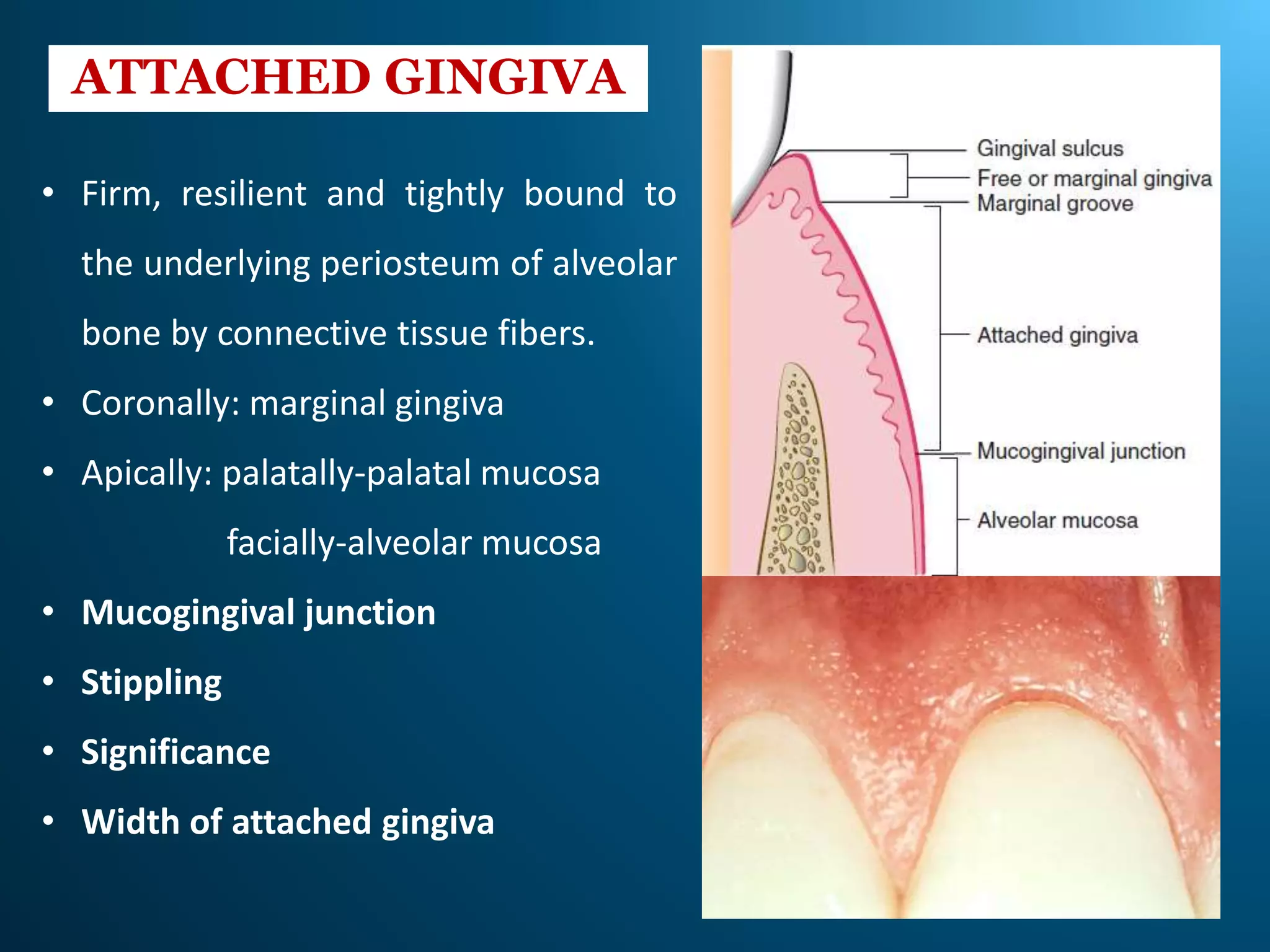 Gingiva | PPTX | Dental Health | Diseases and Conditions