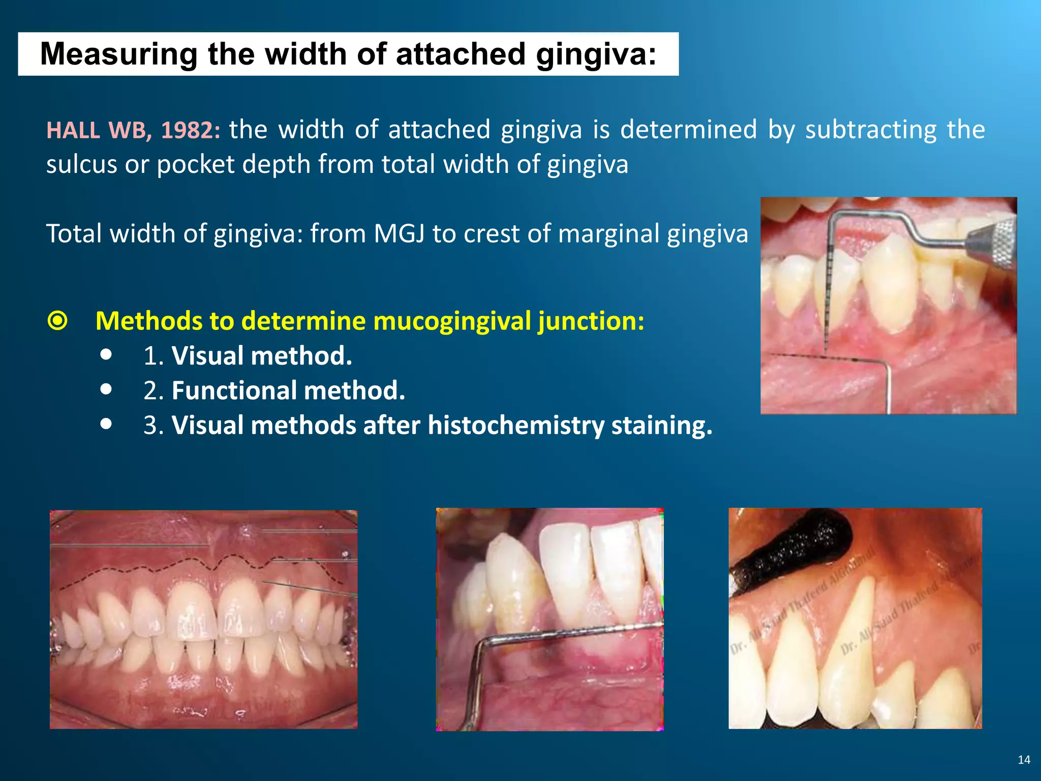 Gingiva | PPTX | Dental Health | Diseases and Conditions