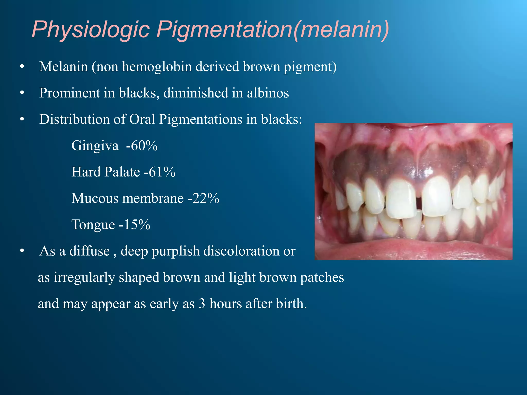 Gingiva | PPTX