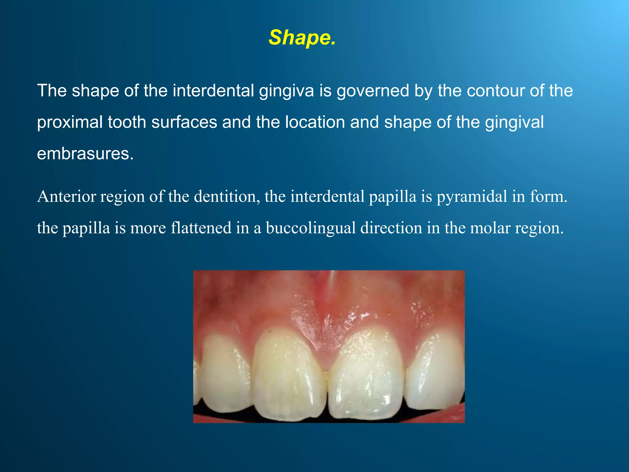 Gingiva | PPTX