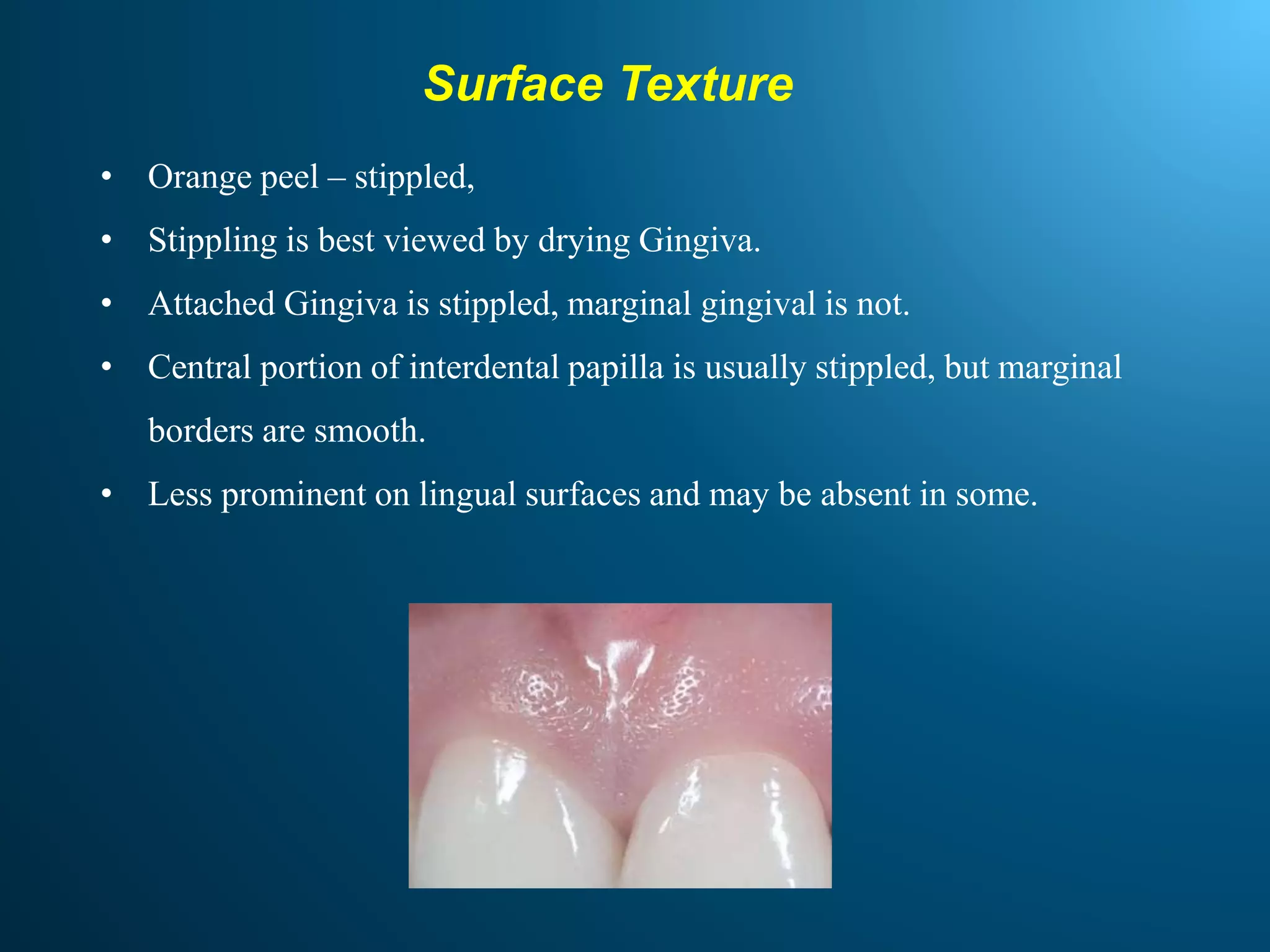 Gingiva | PPTX