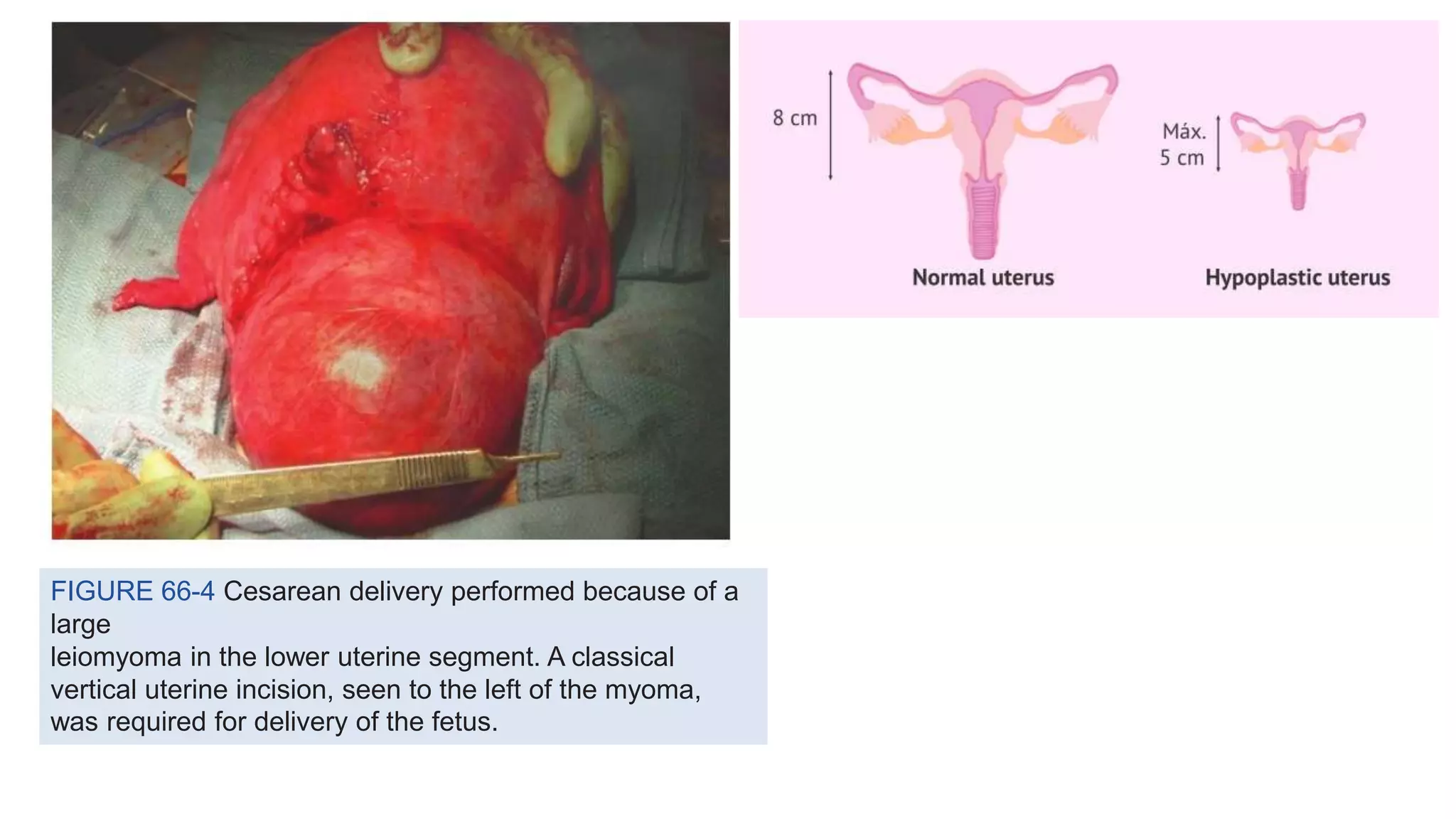 Giải phẫu sinh dục nữ. Female Reproductive Anatomy. | PPTX