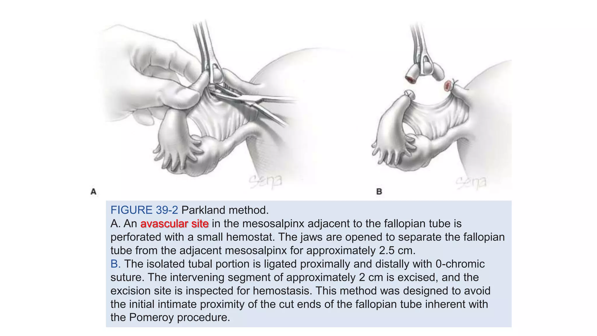 Giải phẫu sinh dục nữ. Female Reproductive Anatomy. | PPTX
