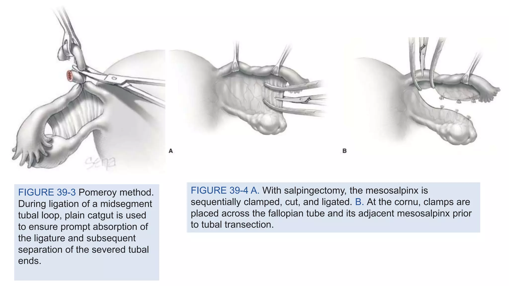 Giải phẫu sinh dục nữ. Female Reproductive Anatomy. | PPTX