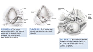 Giải phẫu sinh dục nữ. Female Reproductive Anatomy. | PPTX