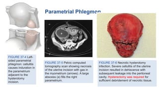 Giải phẫu sinh dục nữ. Female Reproductive Anatomy. | PPTX