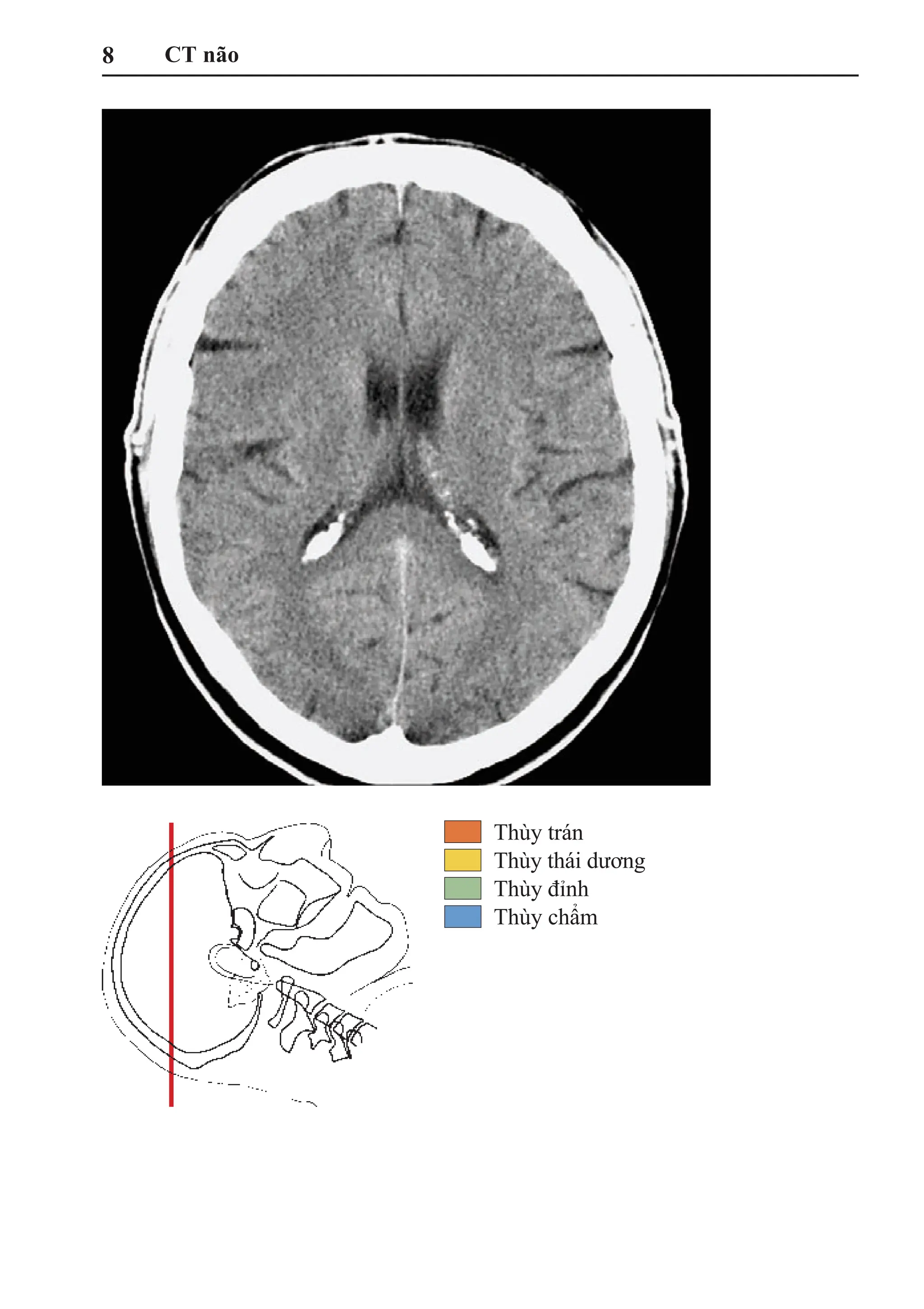Giải phẫu Cắt lớp CT-MRI Tập 1.pdf