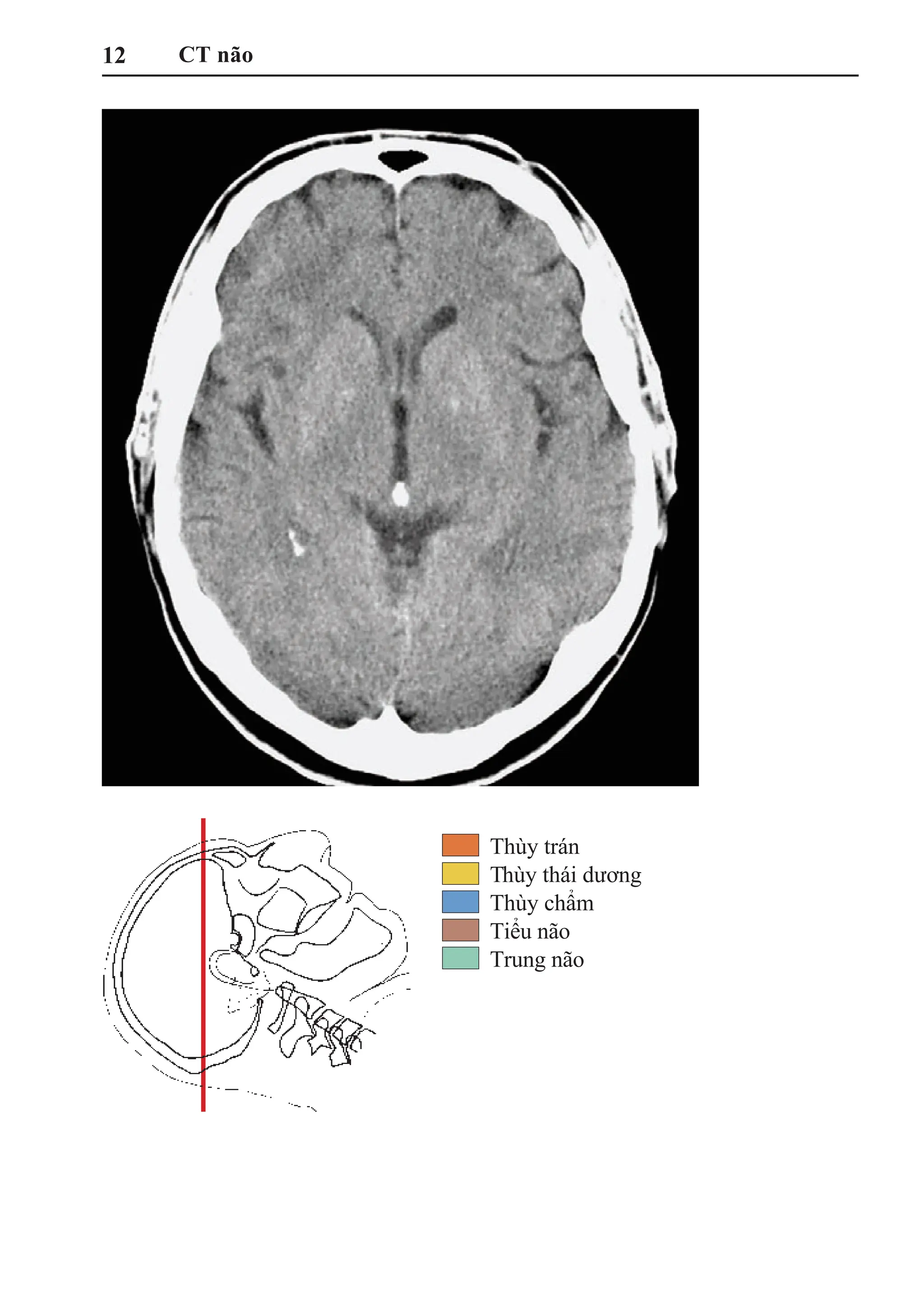 Giải phẫu Cắt lớp CT-MRI Tập 1.pdf