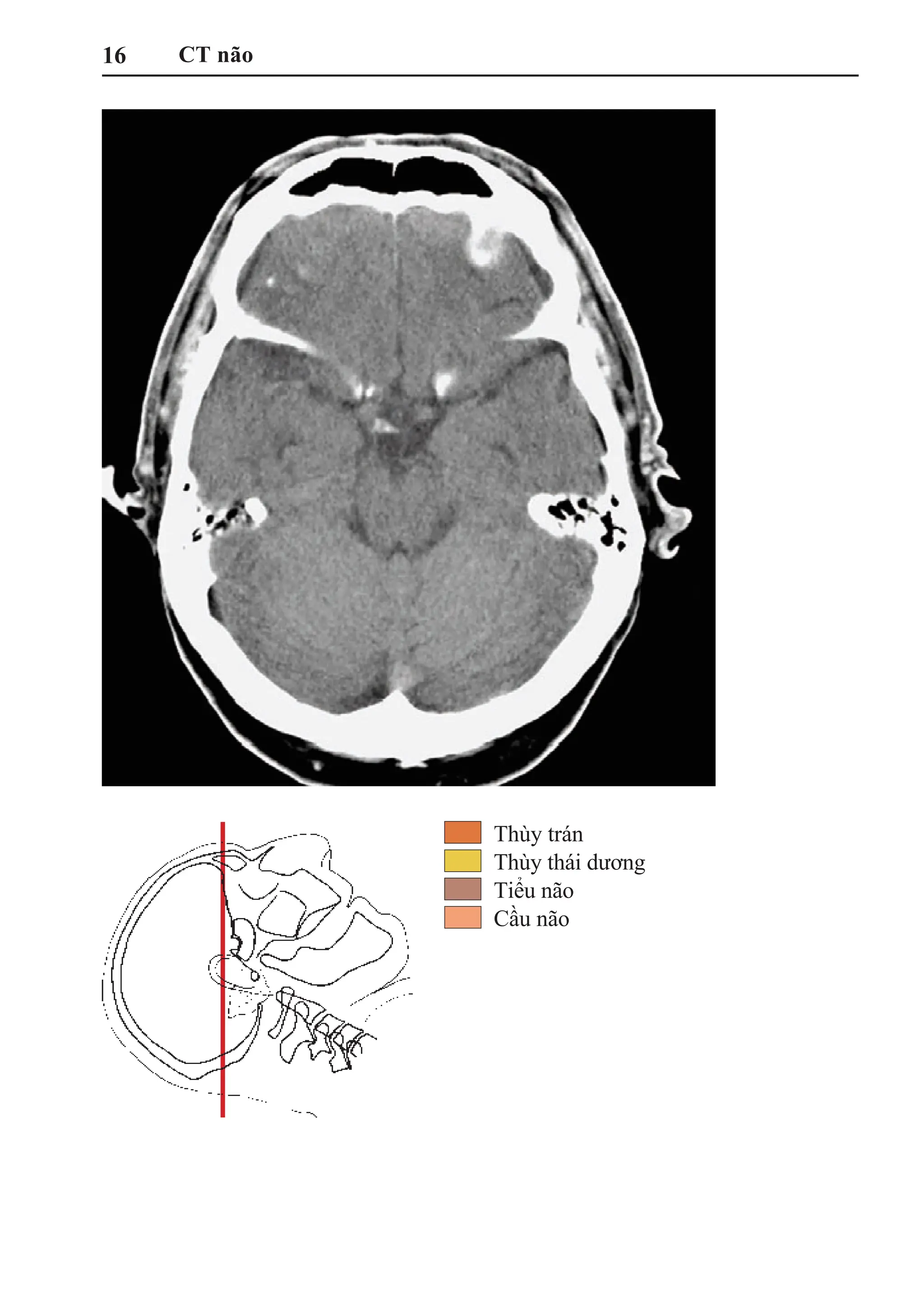 Giải phẫu Cắt lớp CT-MRI Tập 1.pdf