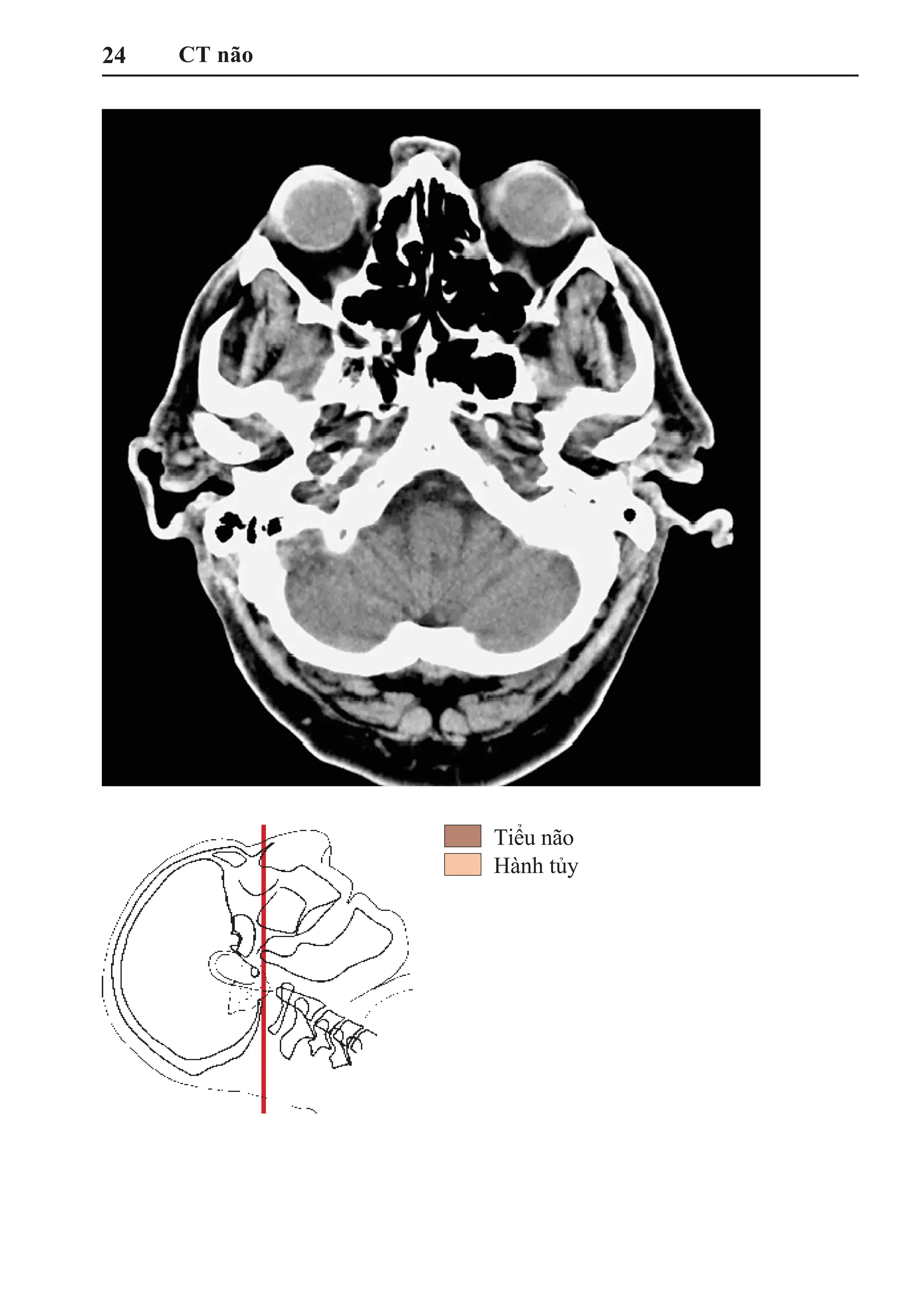 Giải phẫu Cắt lớp CT-MRI Tập 1.pdf