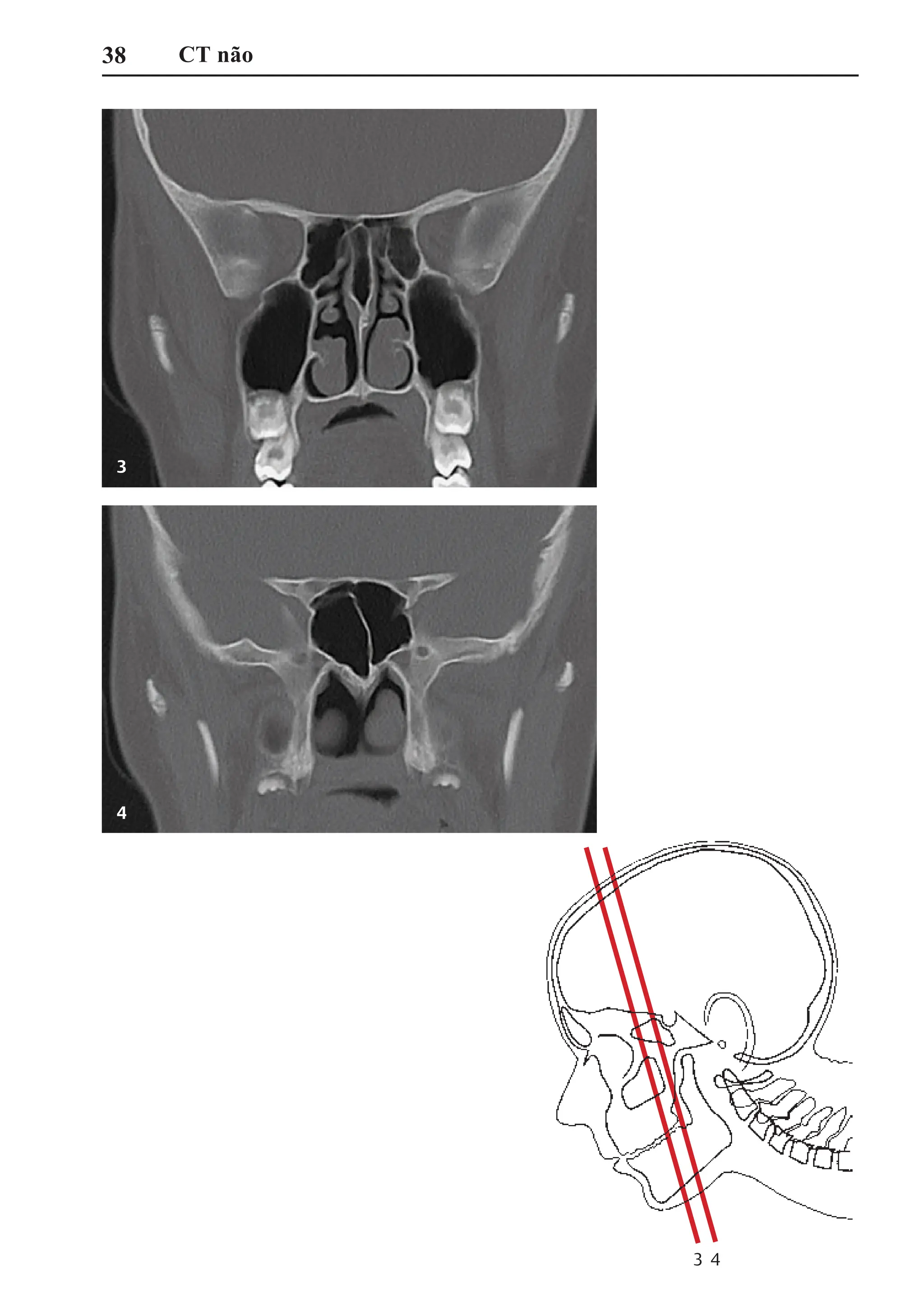 Giải phẫu Cắt lớp CT-MRI Tập 1.pdf