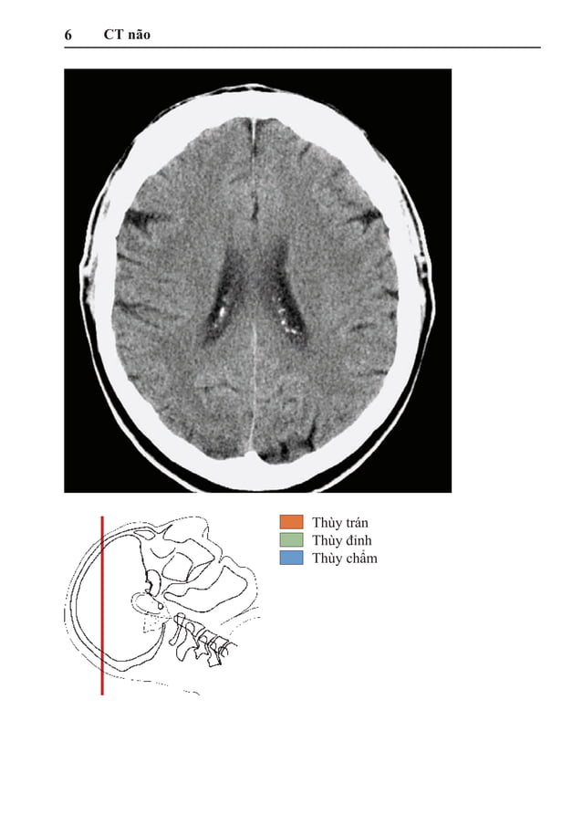 Giải phẫu Cắt lớp CT-MRI Tập 1.pdf