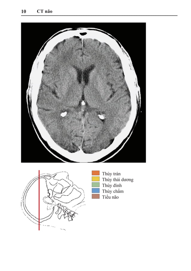 Giải phẫu Cắt lớp CT-MRI Tập 1.pdf