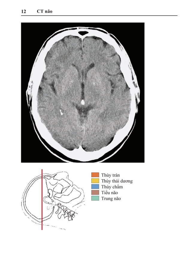 Giải phẫu Cắt lớp CT-MRI Tập 1.pdf
