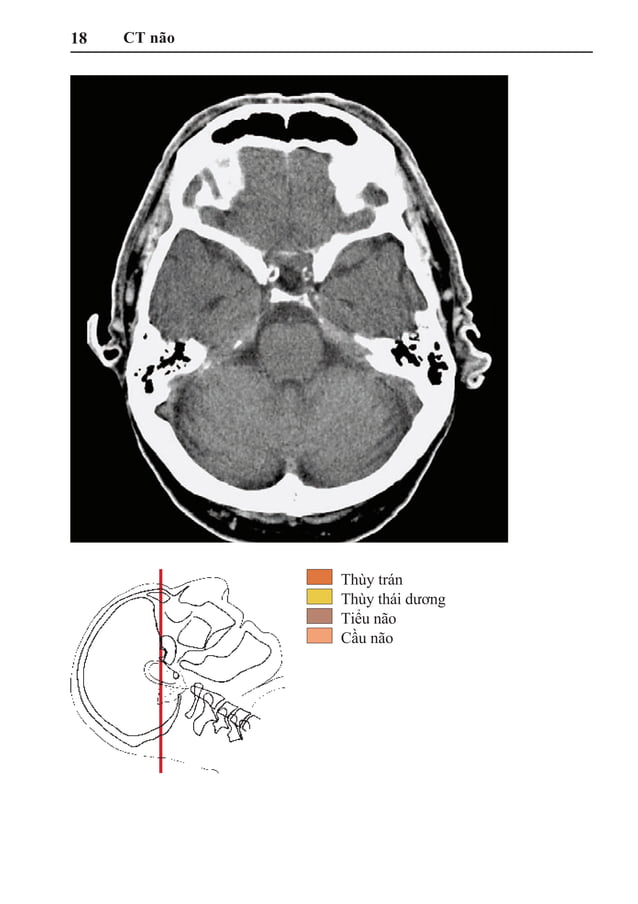 Giải phẫu Cắt lớp CT-MRI Tập 1.pdf