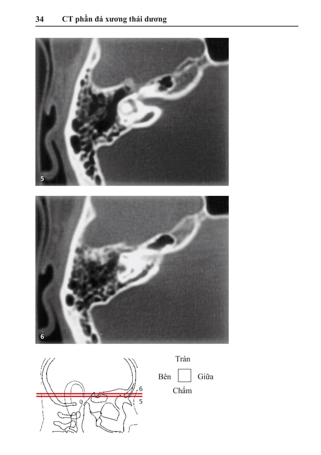 Giải phẫu Cắt lớp CT-MRI Tập 1.pdf
