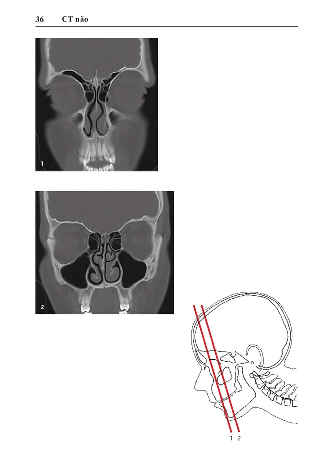Giải phẫu Cắt lớp CT-MRI Tập 1.pdf