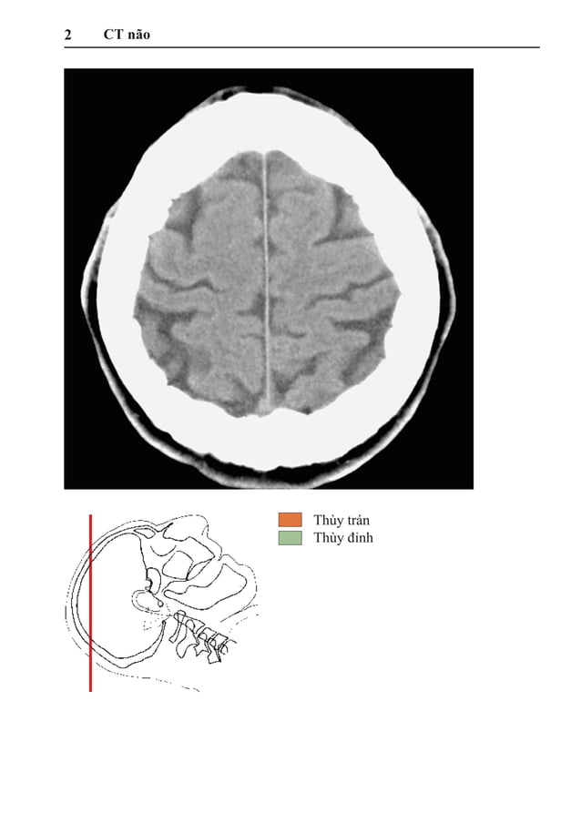 Giải phẫu Cắt lớp CT-MRI Tập 1.pdf