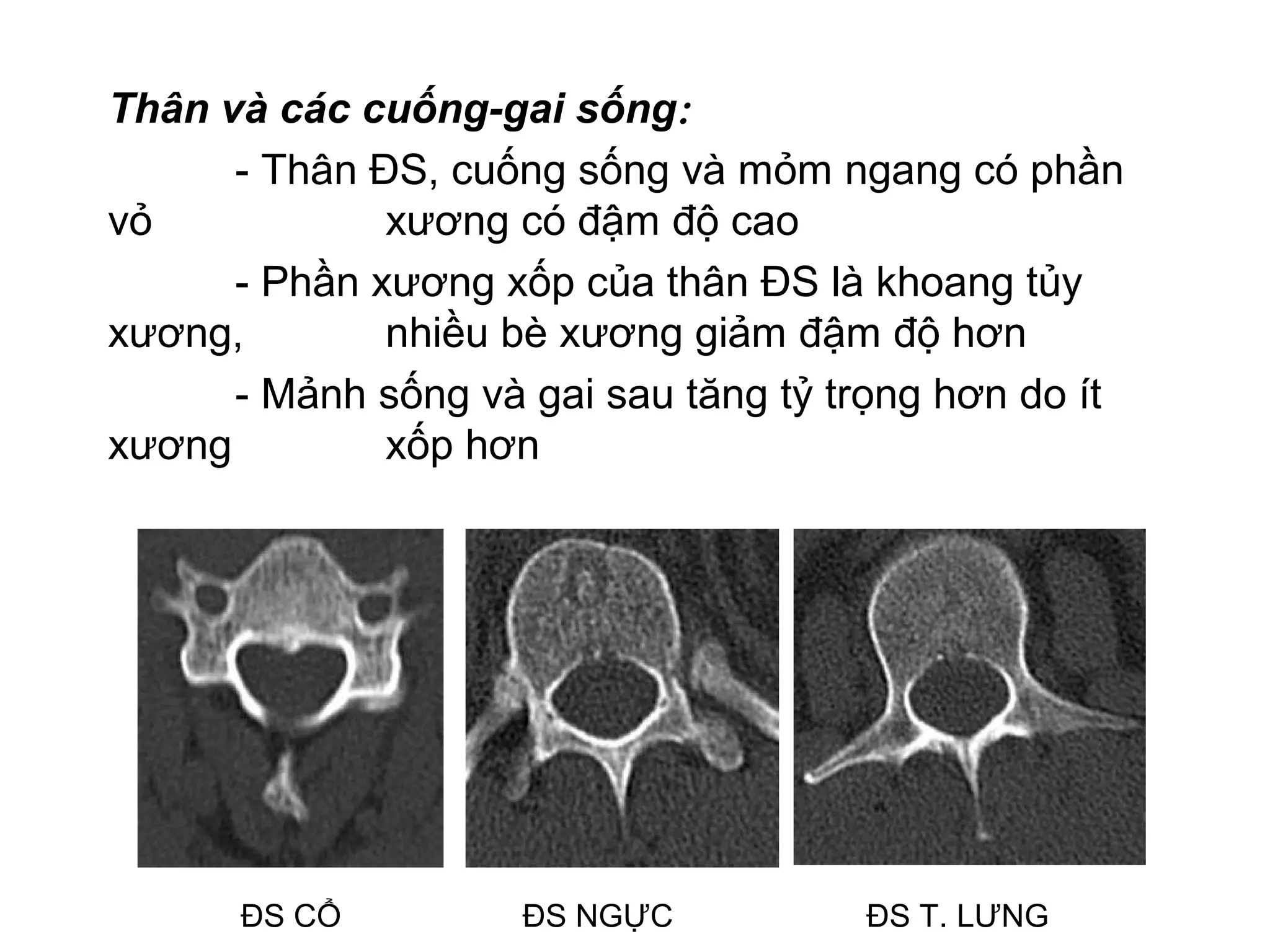 Giải phẫu cột sống và hình ảnh chấn thương cột sống trên clvt | PPT