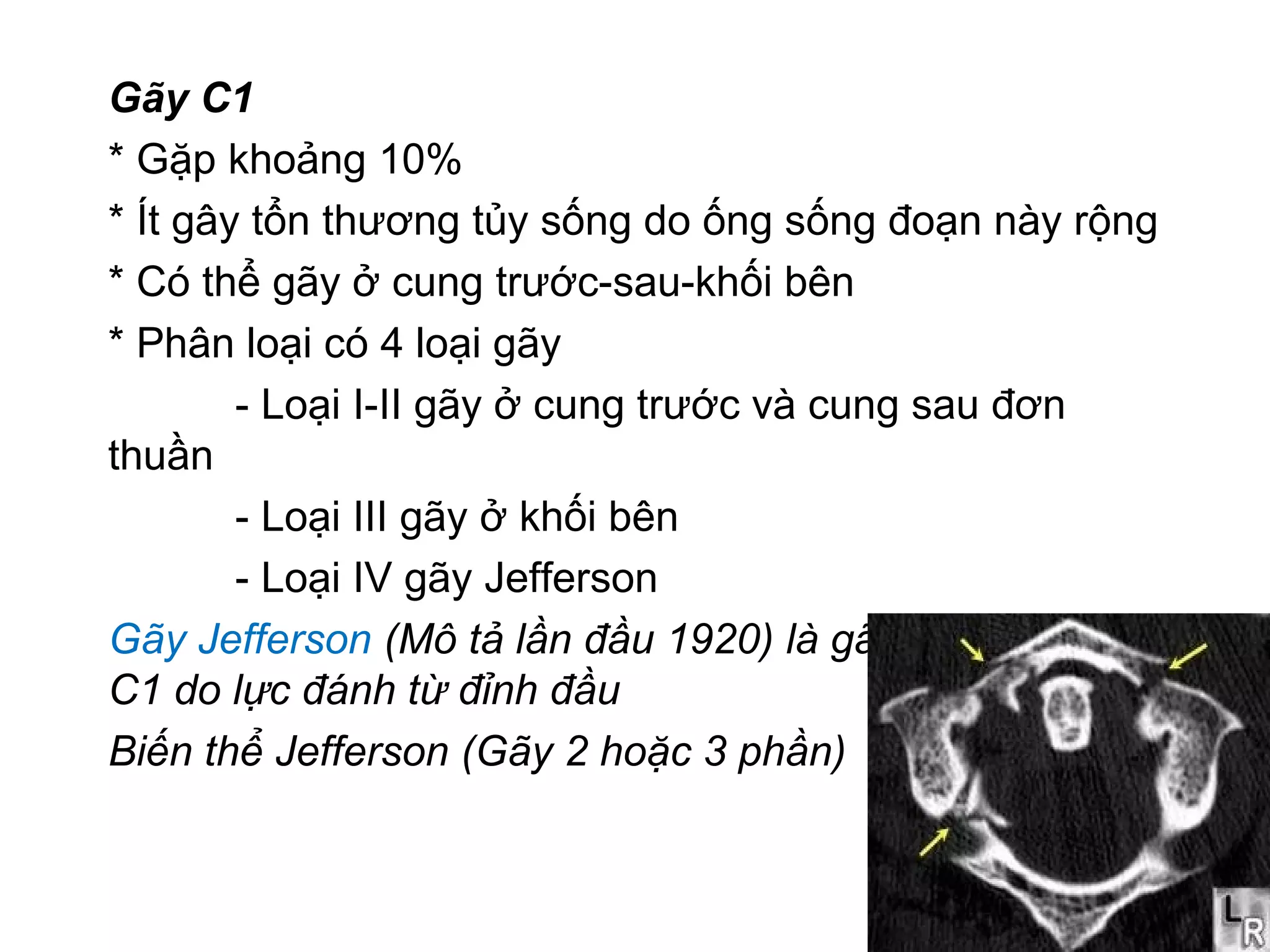 Giải phẫu cột sống và hình ảnh chấn thương cột sống trên clvt | PPT