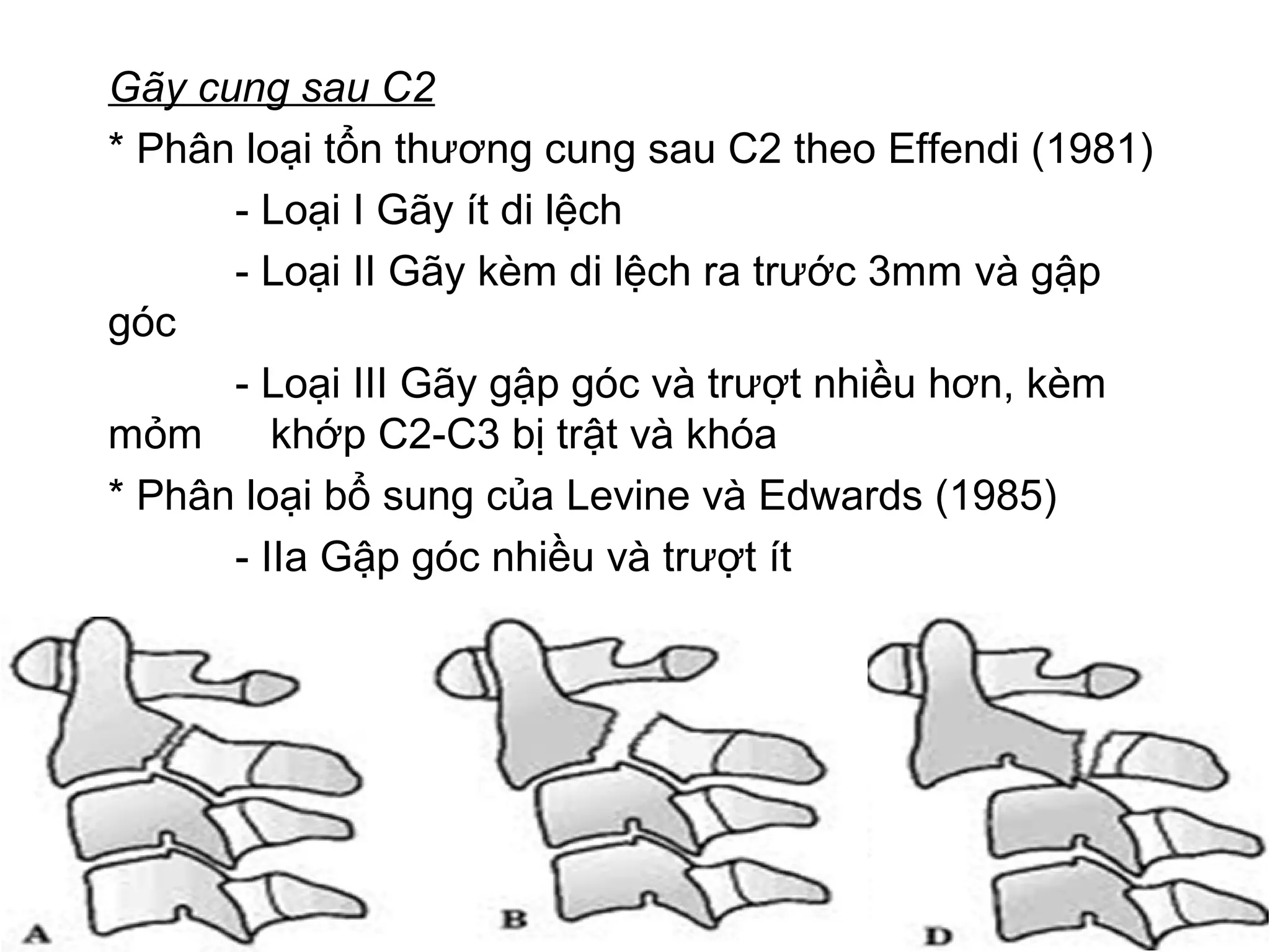 Giải phẫu cột sống và hình ảnh chấn thương cột sống trên clvt | PPT