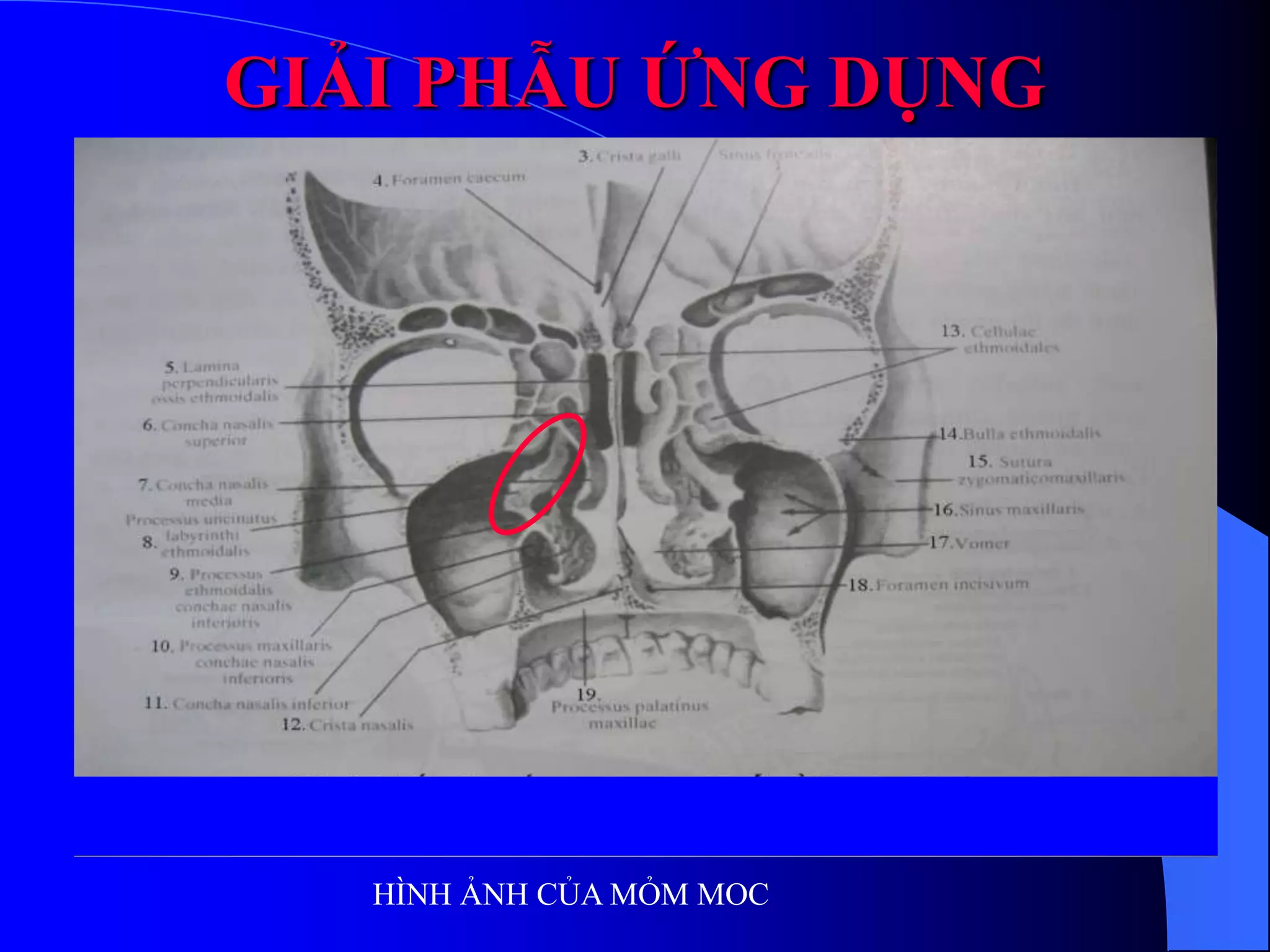Giải phẫu mũi xoang.pptx