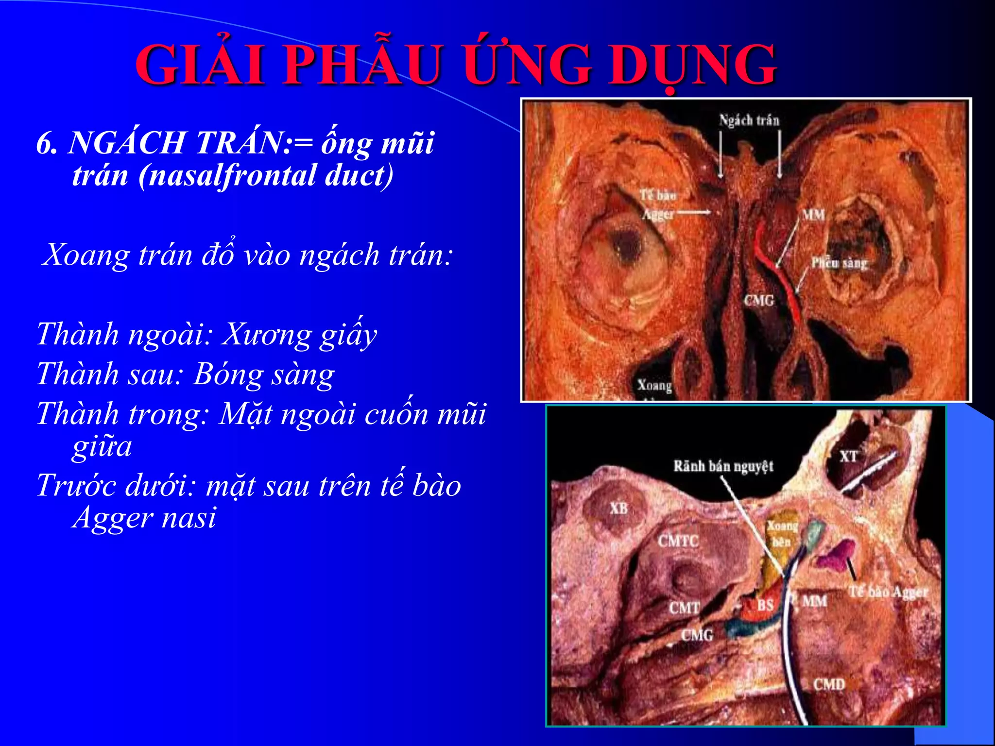 Giải phẫu mũi xoang.pptx