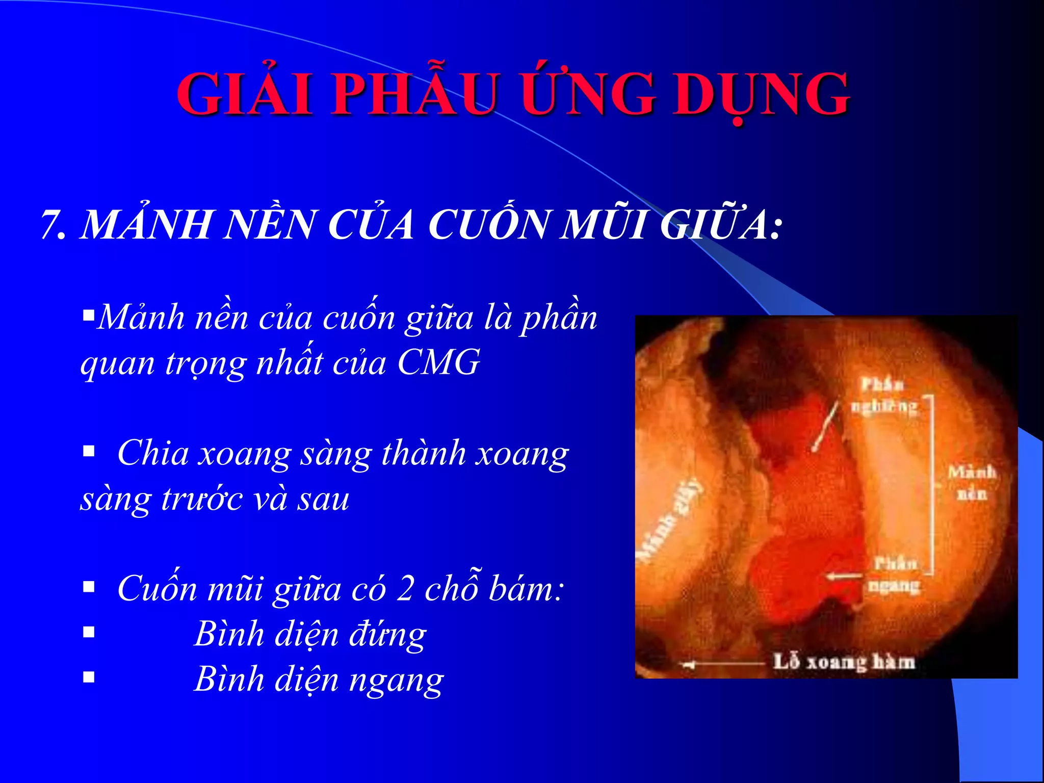Giải phẫu mũi xoang.pptx