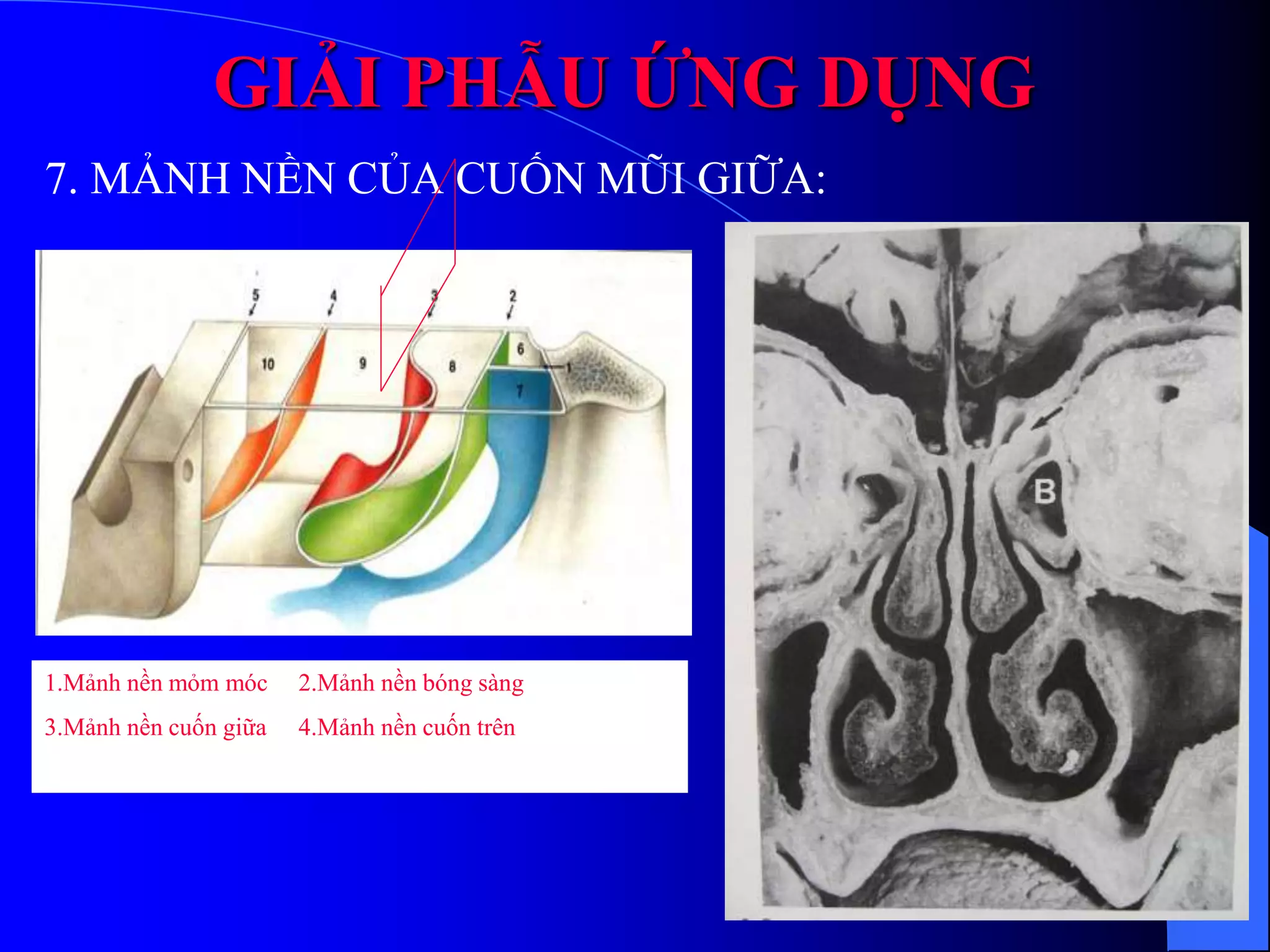 Giải phẫu mũi xoang.pptx