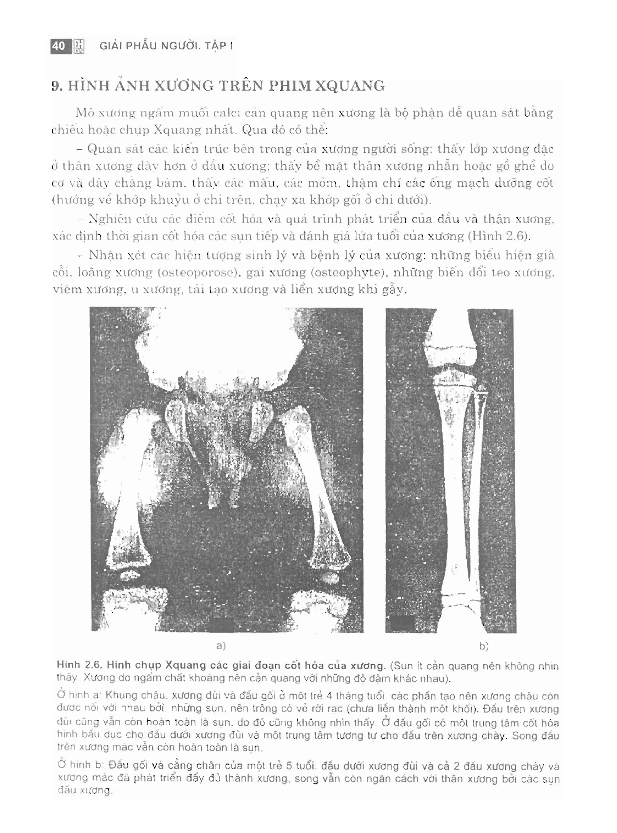 Giải phẫu người tập 1 gs. trịnh văn minh byt | PDF