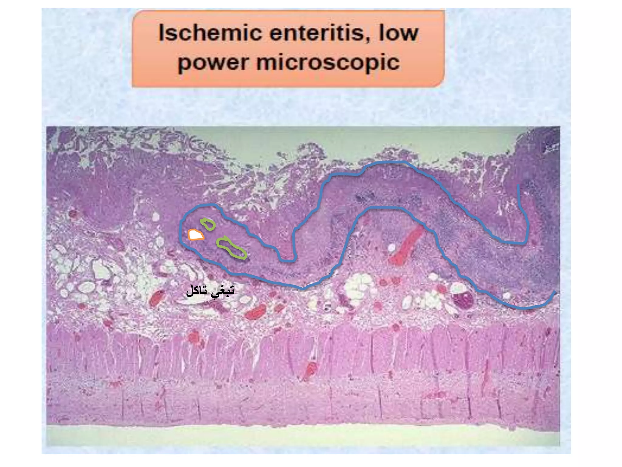 Gi lab | PPT | Free Download