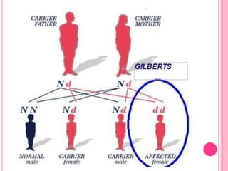 Gilbert syndrome | PPTX