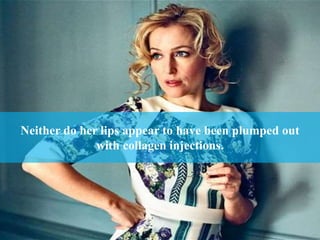Gillian anderson plastic surgery | PPTX