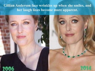 Gillian anderson plastic surgery | PPTX